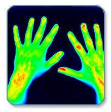 Rheumatologie Rheumatologe Neuss Köln Düsseldorf